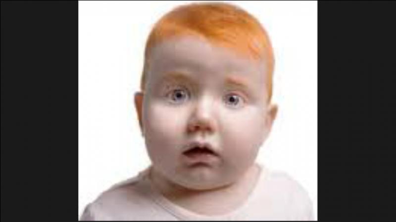 ☑ pourquoi mon fils est roux